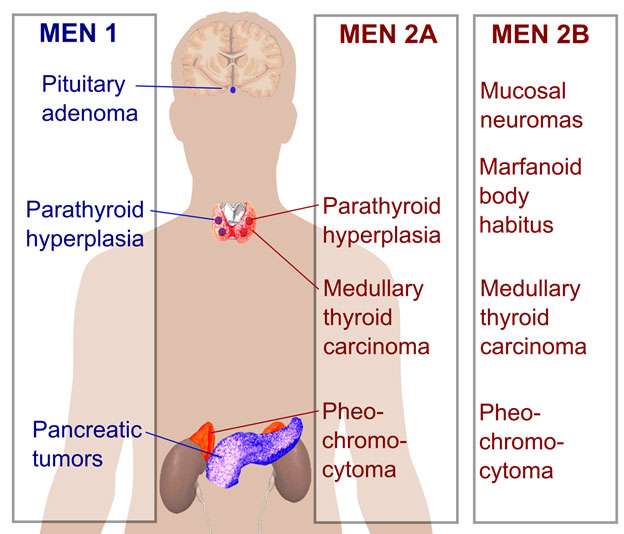 Genetic Syndromes - Endocrine Surgery | UCLA Health