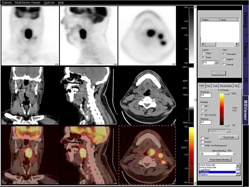 Functional Image-Guided Radiation Therapy - Radiation Oncology | UCLA ...
