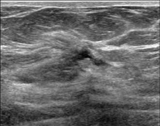 Ultrasound: Associated Features - Radiology | UCLA Health