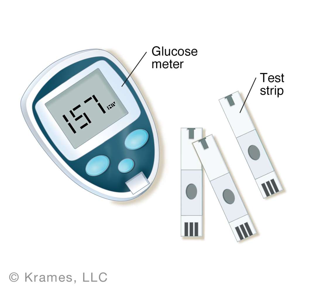 Treatment - Type 1 Diabetes | UCLA Health