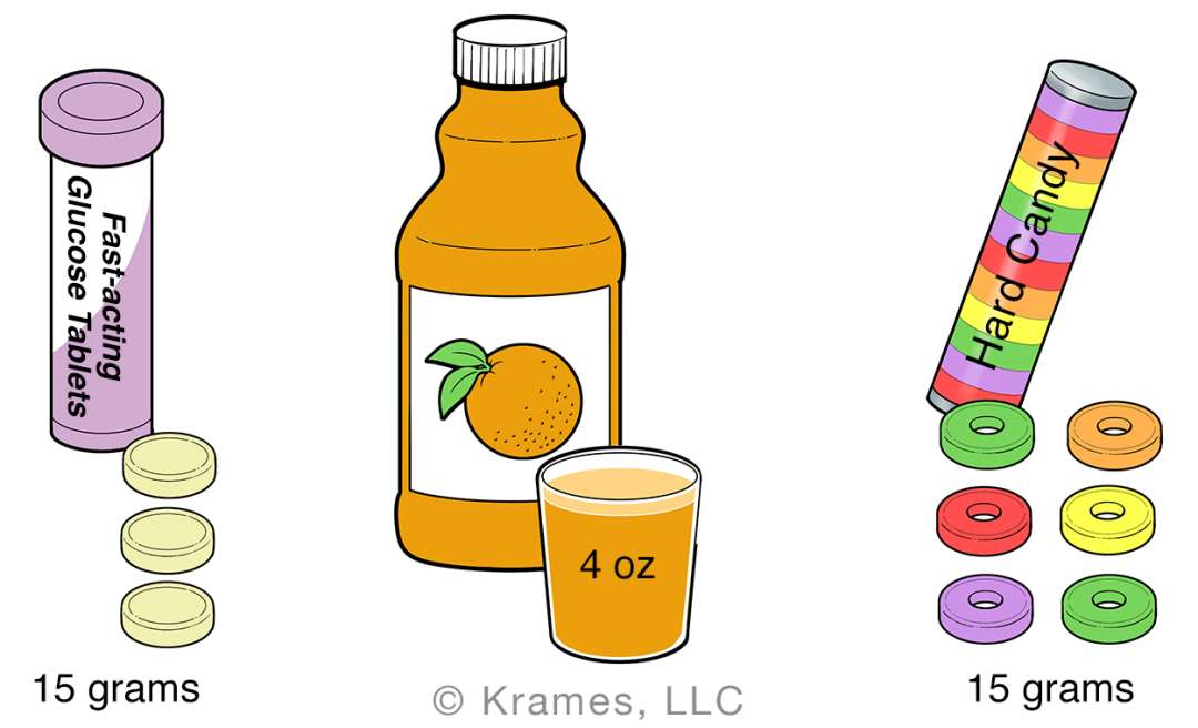 Hypoglycemia - Type 1 Diabetes | UCLA Health