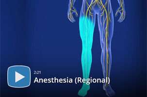 Types of Anesthesia - Anesthesiology | UCLA Health