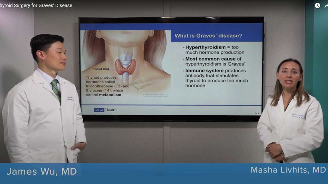 Hyperthyroidism - Endocrine Surgery | UCLA Health