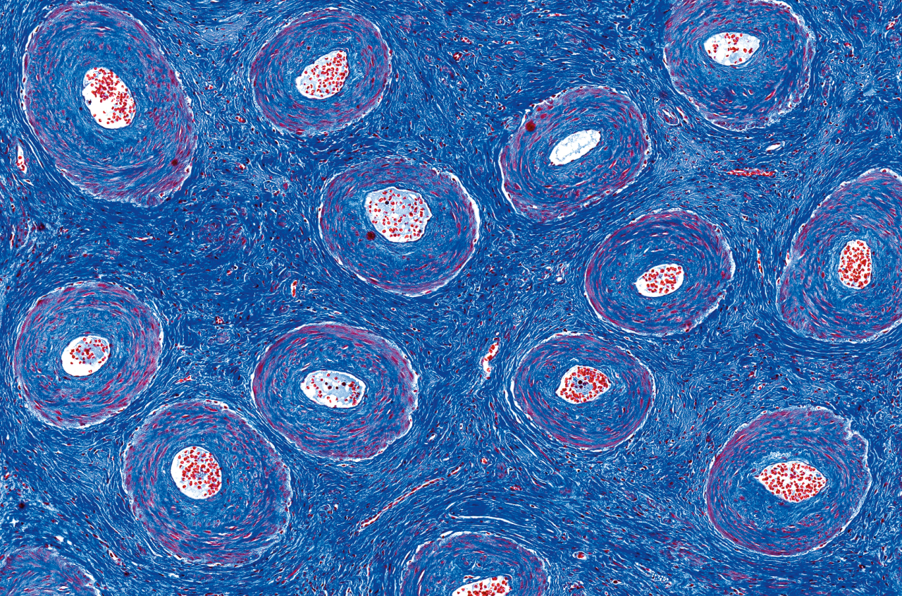 Decoding the Mysteries of Ovaries | UCLA Health