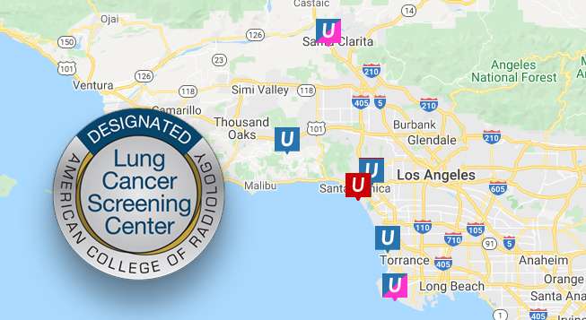 Schedule an Appointment - Lung Cancer | UCLA Health Jonsson ...