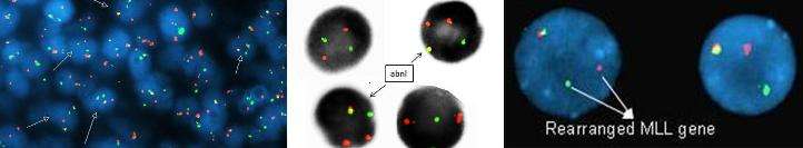 Cytogenetics Laboratory - Pathology | UCLA Health