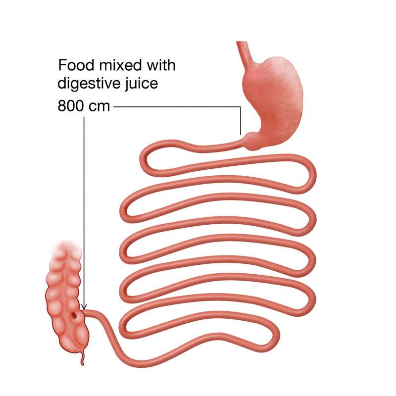 Gastric Bypass Revision - Bariatric Surgery | UCLA Health