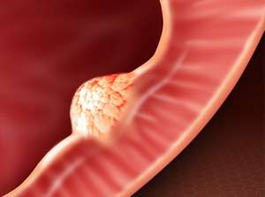 Video Library: Medical Procedures & Surgeries | UCLA Health