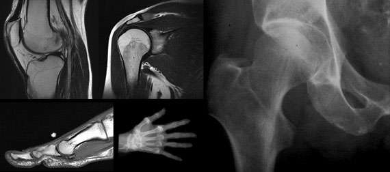 Musculoskeletal Imaging - Radiology | UCLA Health