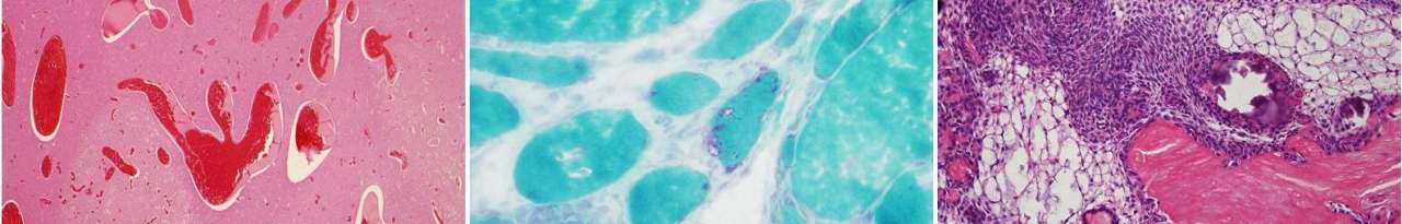 Neuropathology - Pathology | UCLA Health