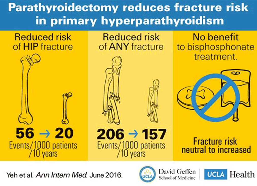 Parathyroidectomy - Parathyroid Surgery - Endocrine Surgery | UCLA Health
