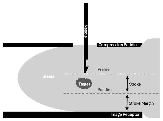 How to Perform: Stereotactic (Mammographic Guided Biopsy) - Radiology ...