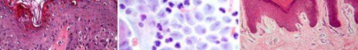 Dermatopathology - Pathology | UCLA Health