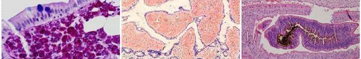 Gastrointestinal Pathology - Pathology | UCLA Health