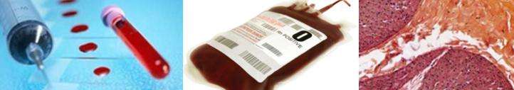 Transfusion Medicine - Pathology | UCLA Health