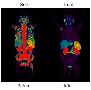 Theranostics | UCLA Health