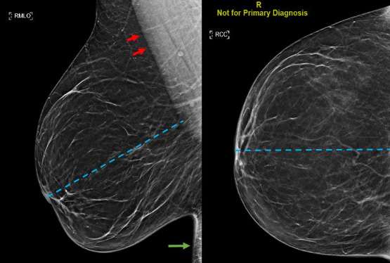 Positioning and Technique - Radiology | UCLA Health