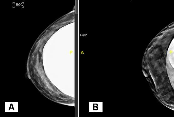 Positioning and Technique - Radiology | UCLA Health