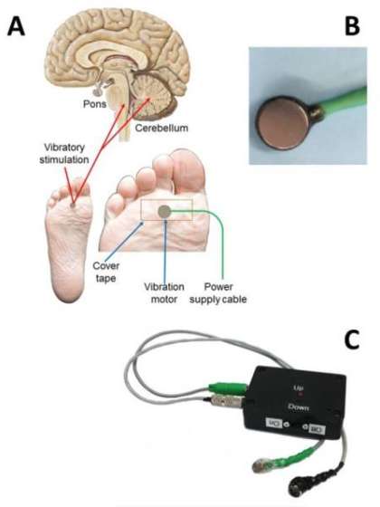 A dime-size buzzer on the foot could reduce epileptic seizures | UCLA ...