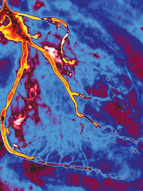 Interventional Cardiology - Los Angeles, CA | UCLA Health