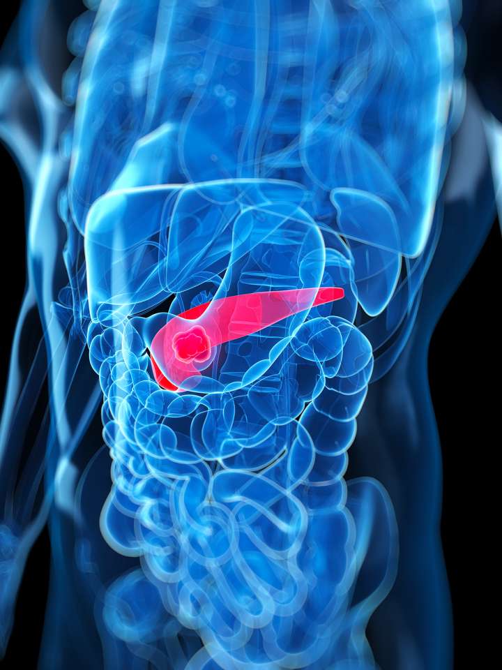 Pancreatic Cancer Care | UCLA Health Jonsson Comprehensive Cancer Center