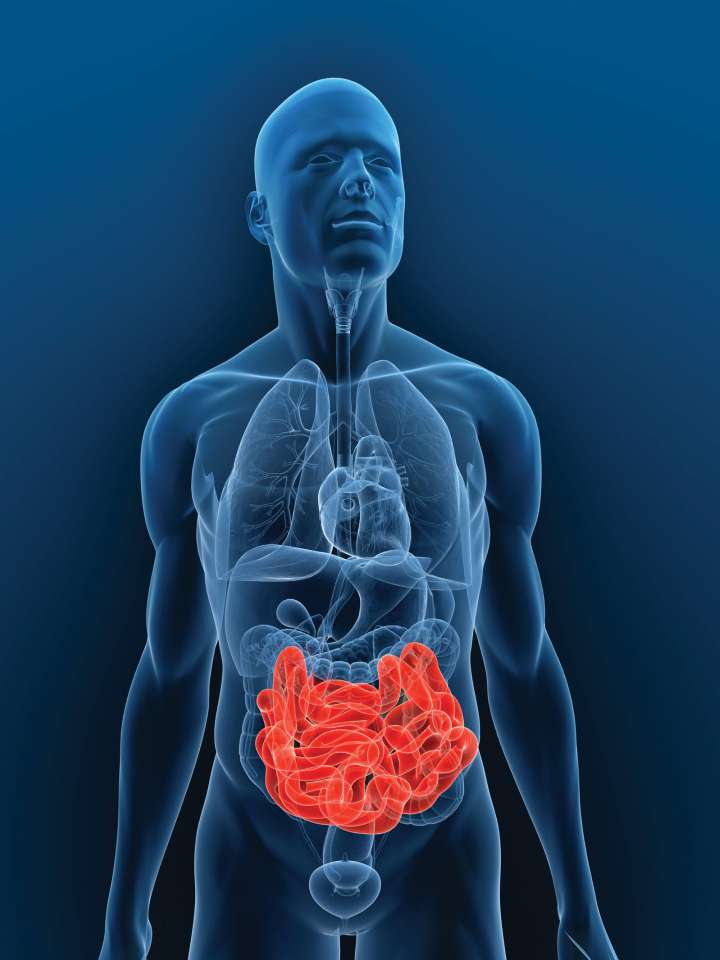 Intestinal Transplant - Los Angeles, CA | UCLA Health