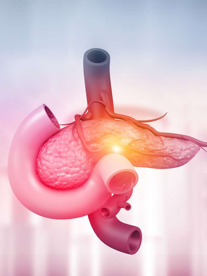 Pancreatic Disease & Treatment | UCLA Health