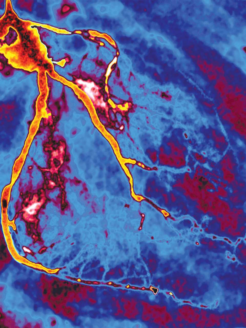 Interventional Cardiology - Los Angeles, CA | UCLA Health