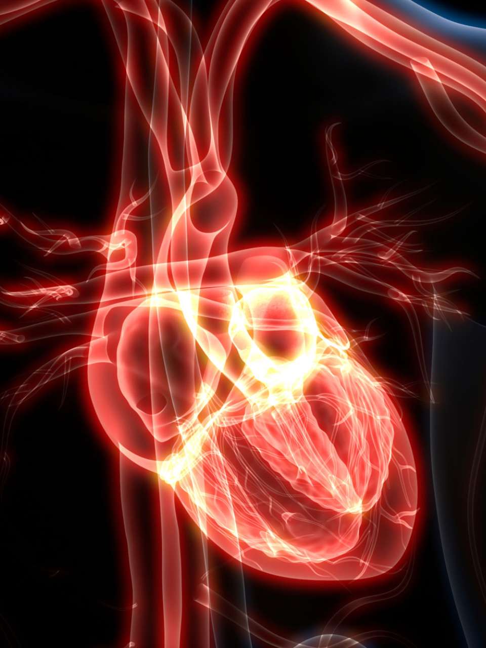 Advanced Heart Failure - Los Angeles, CA | UCLA Health