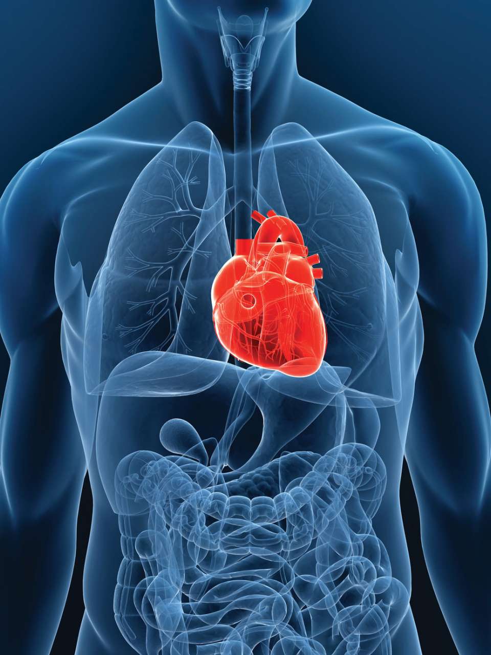 IVC Filter Placement and Removal - Los Angeles, CA | UCLA Health