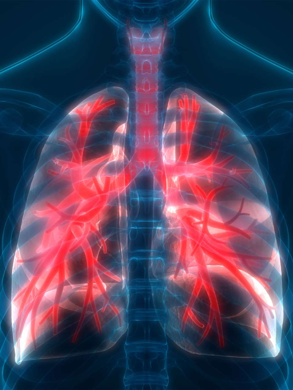 COPD - Los Angeles, CA | UCLA Health