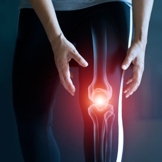 UCLA Division of Rheumatology | UCLA Health