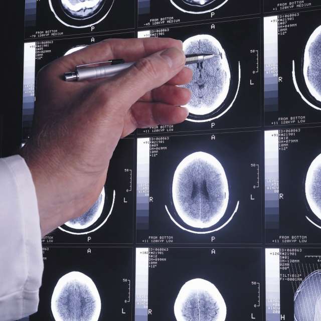Lead exposure linked to Parkinson's disease | UCLA Health