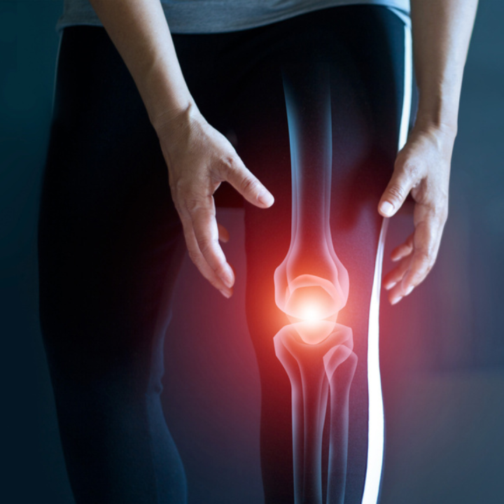 UCLA Division of Rheumatology | UCLA Health